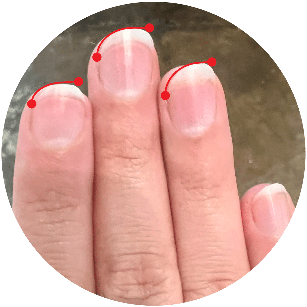 Guitar Fingernails: Classical Guitar Nail Shape & FAQ [Guide]